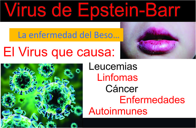 Virus de Epstein-Barr, Tratamiento con Homeopatia – Centro para el ...